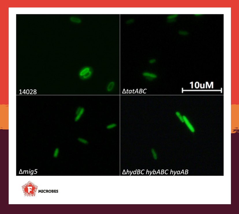 A strategy to beat bacteria at their own antibiotic resistance game