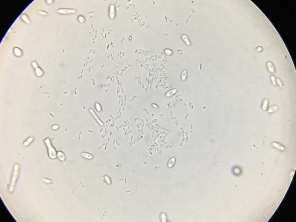 #FEMSmicroBlog: About the microbes in kombucha