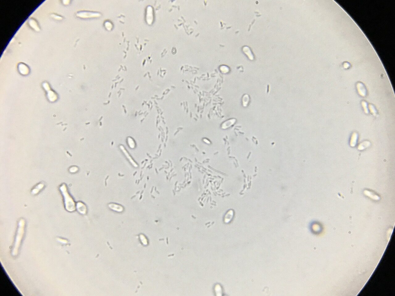 #FEMSmicroBlog: About the microbes in kombucha