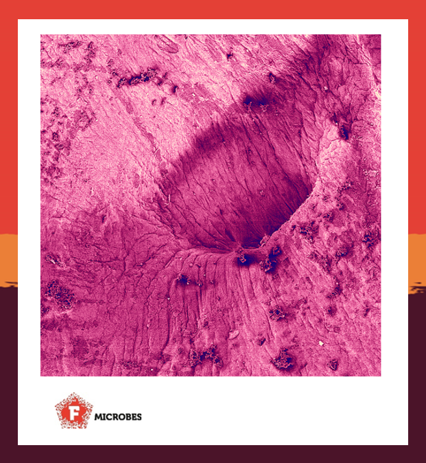 Enterococcus faecalis induces infectious endocarditis without damage