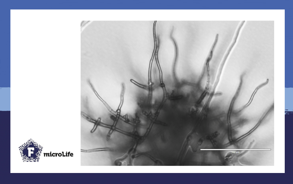 #FEMSmicroBlog: Fungal drops to visualize the soil mycelium