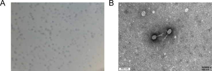 #FEMSmicroBlog: New viruses discovered in 2025 - FEMS